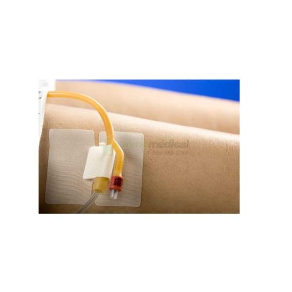Stabilisateur de sonde urinaire Cath-Secure | D-54453 – Stomo Médical